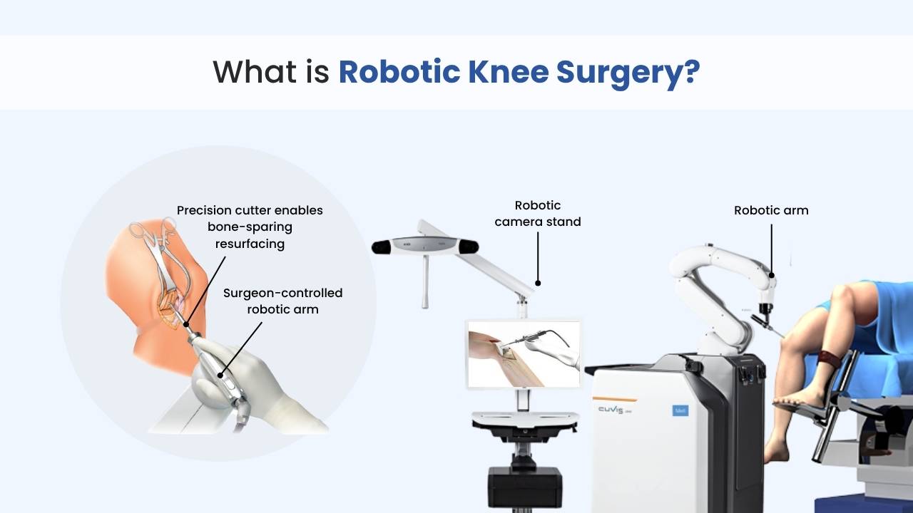 Advantages and Disadvantages of Robotic Knee Surgery