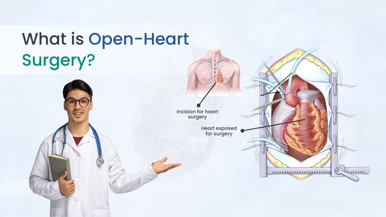 Bypass vs Open Heart Surgery: Key Differences