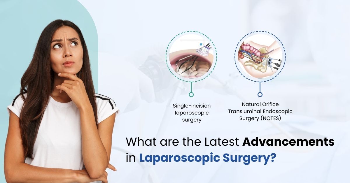 What is Advanced Laparoscopic Surgery? A Complete Guide.