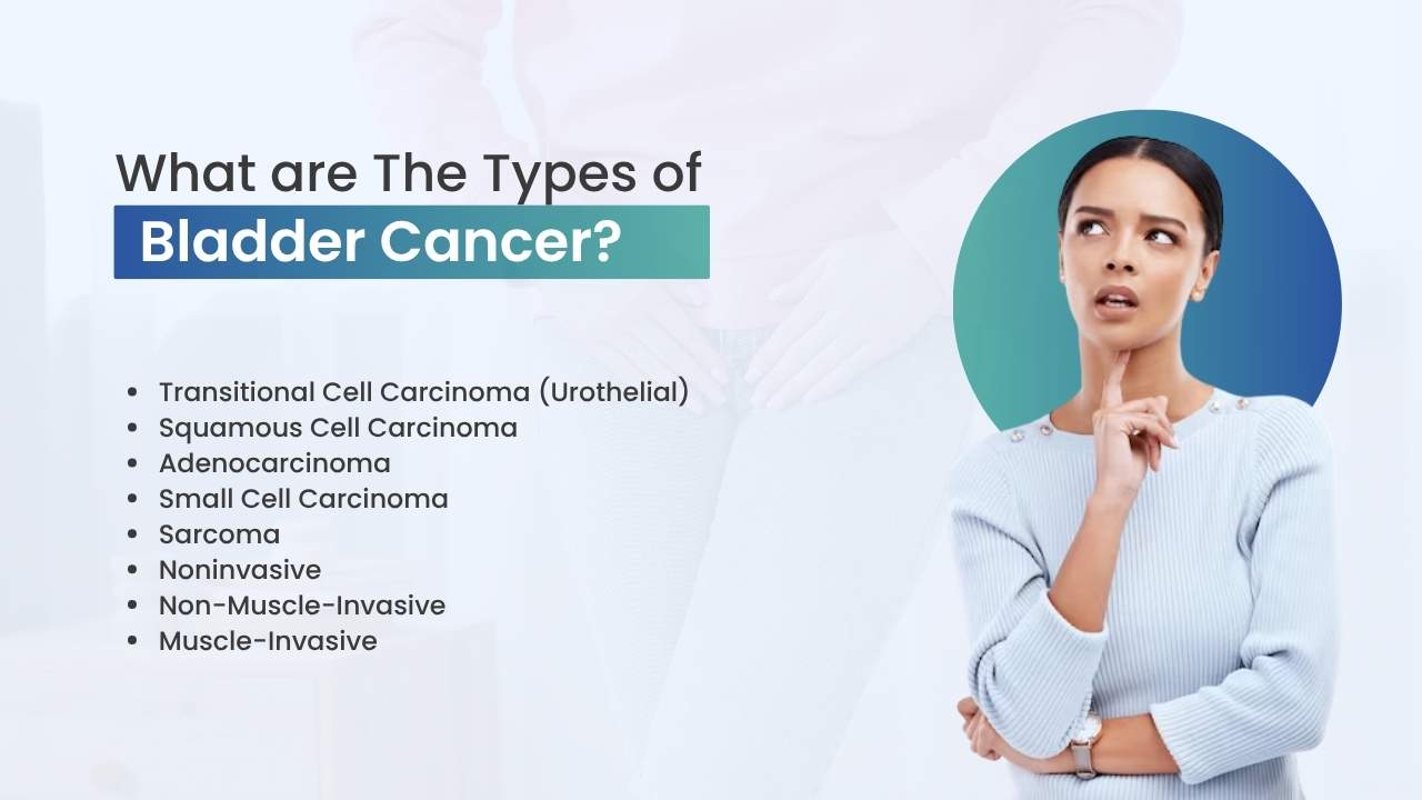 Advanced Bladder Cancer Surgery in India: Types, Cost, and Recovery Guide