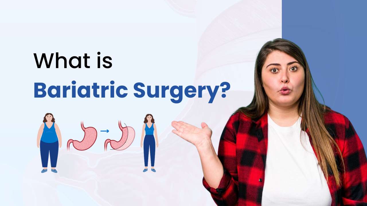 Types of Bariatric Surgery: Which One is Right For You?