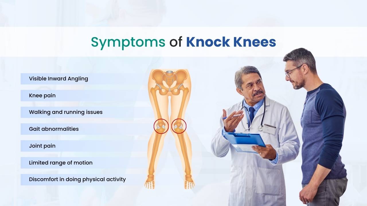 Knock Knee Surgery| Benefits, Risks & Recovery Time
