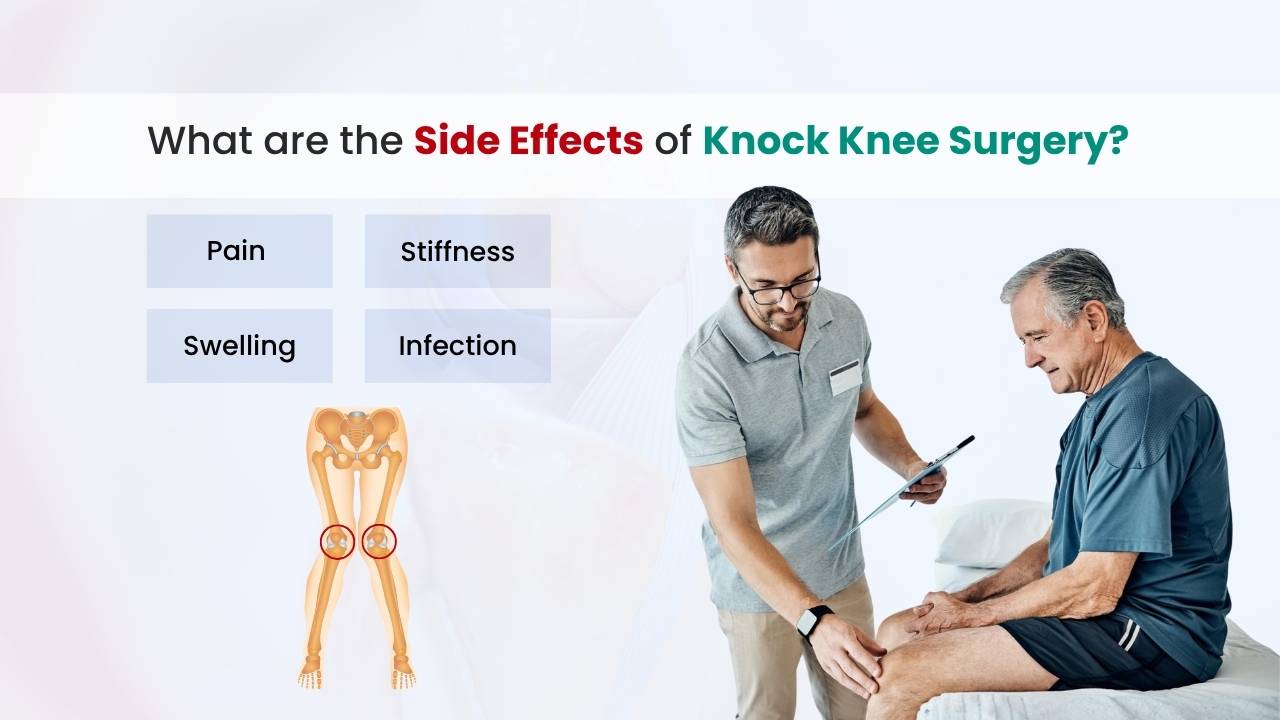 Knock Knee Surgery| Benefits, Risks & Recovery Time