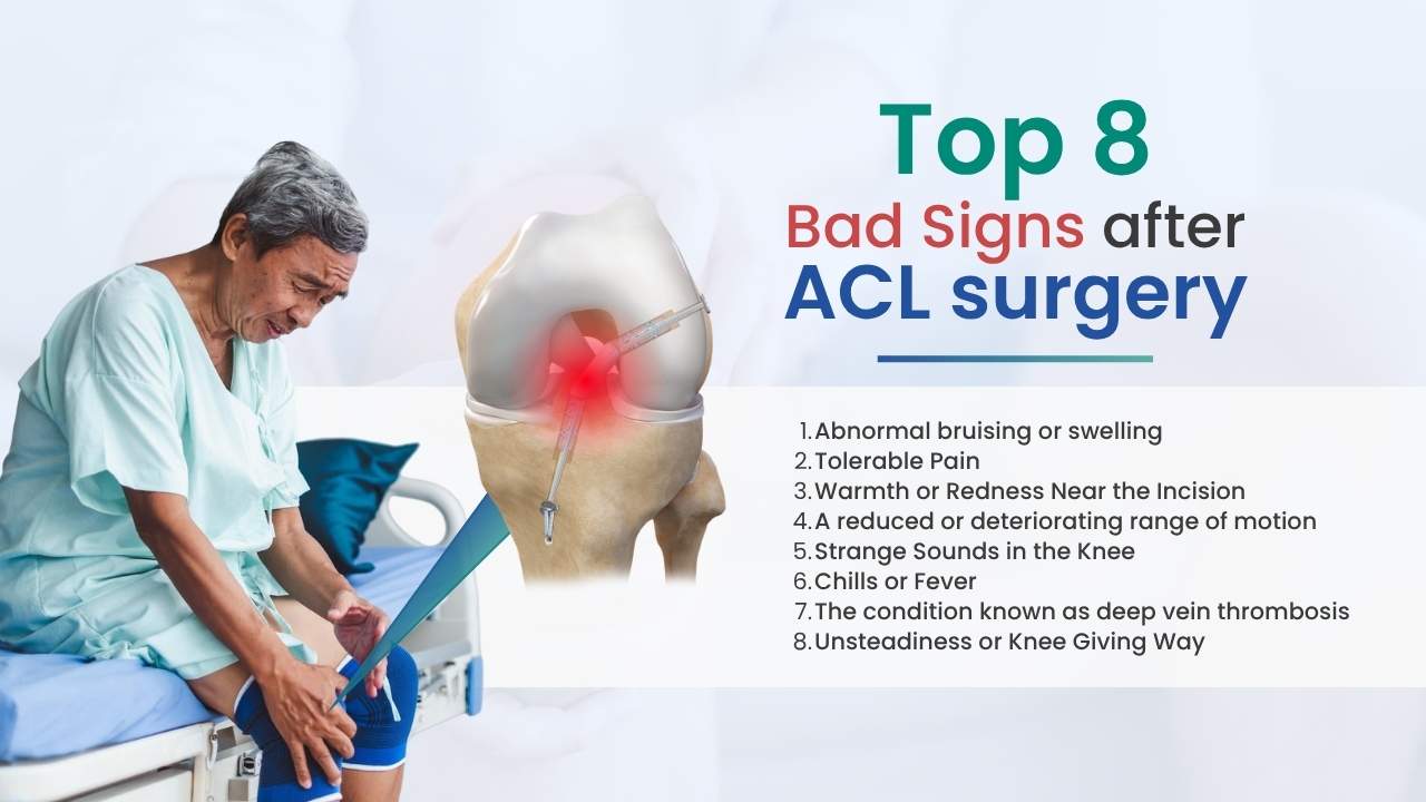 Bad Signs After ACL Surgery : you can't ignore