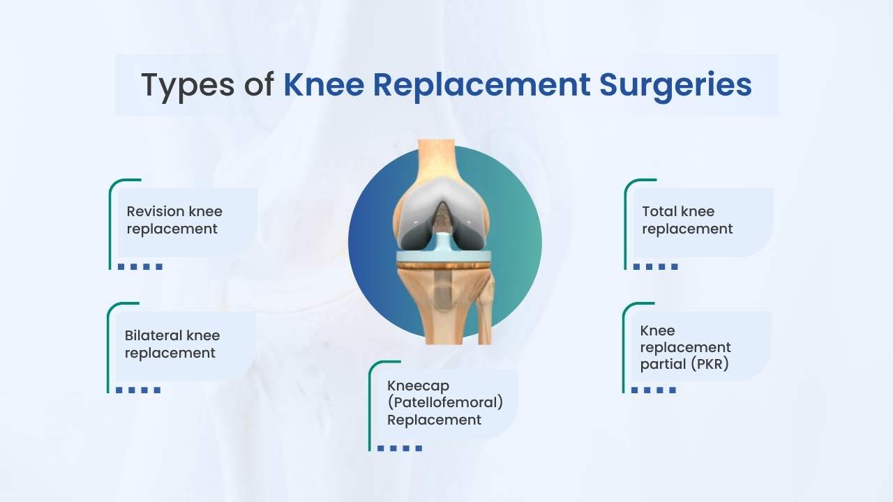 Knee Replacement: Common Mistakes to avoid That Can Delay Healing
