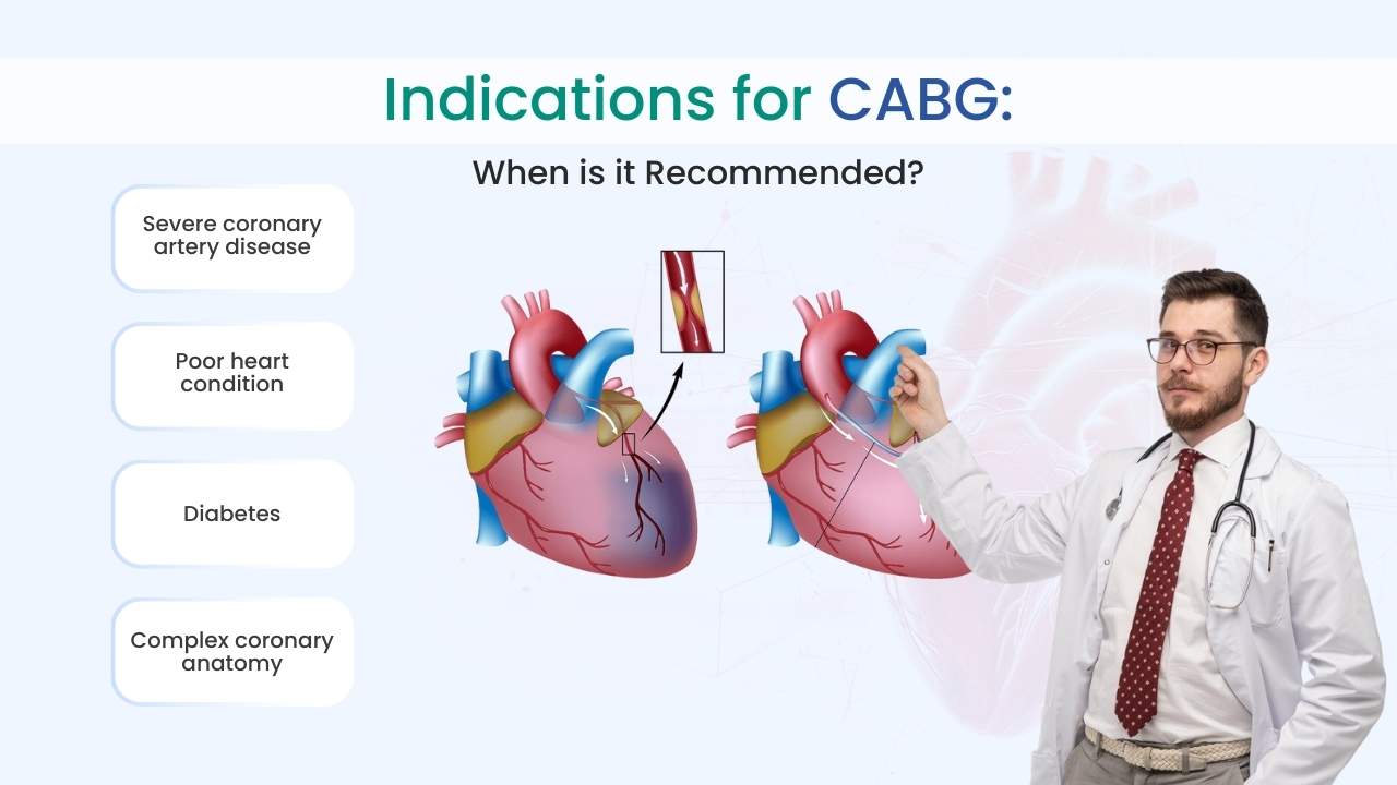 CABG Surgery: Coronary Artery Bypass Grafting Guide