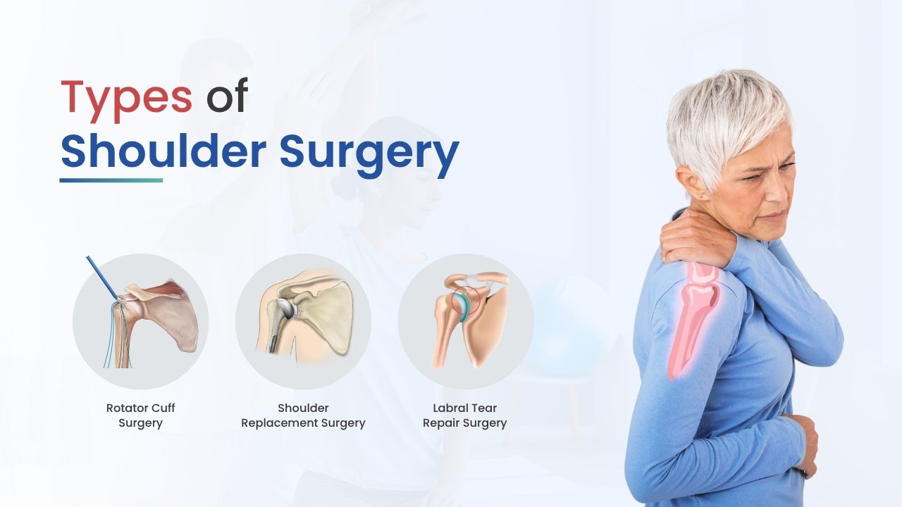 Shoulder Surgery | A Timeline for recovery