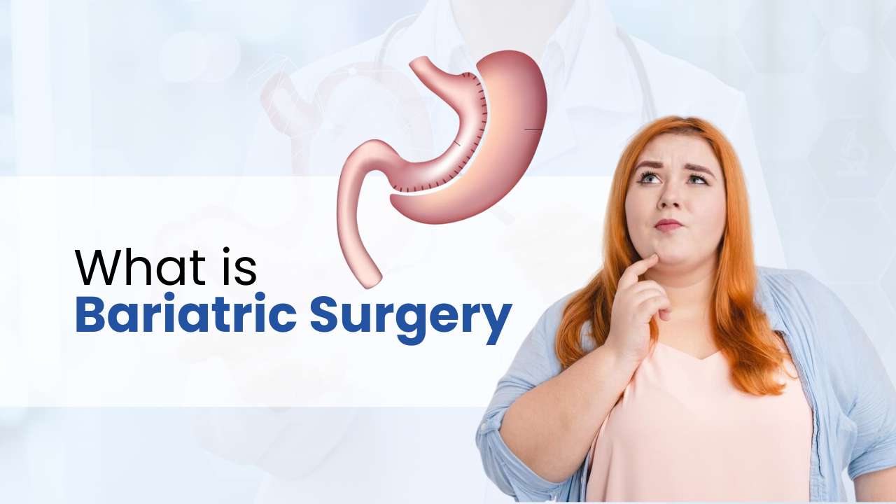 Bariatric Surgery and Hair Loss | Why It Happens and How to Stop It