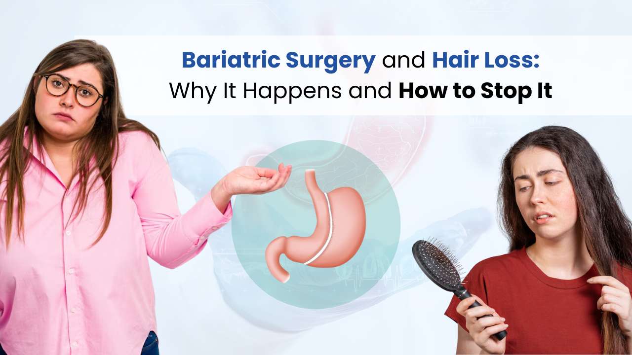 Bariatric Surgery and Hair Loss | Why It Happens and How to Stop It