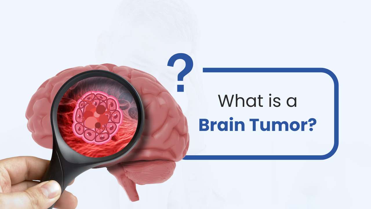 10 Early Brain Tumor Symptoms You Should Be Aware Of