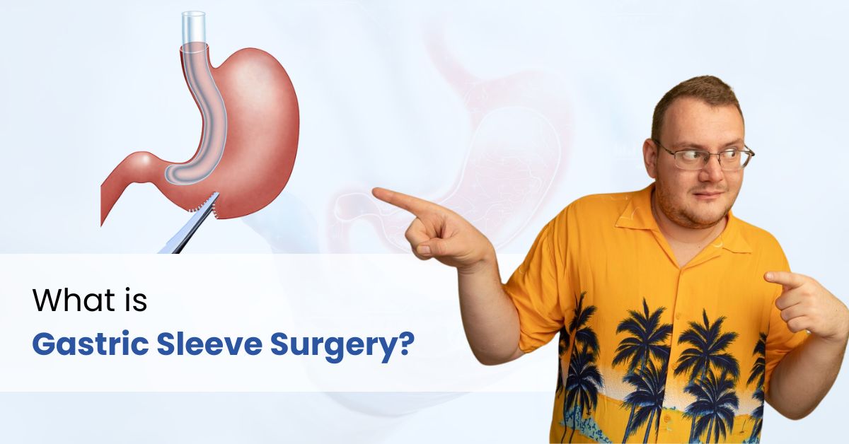 Gastric Sleeve Surgery Explained | What You Should Know Before Choosing It