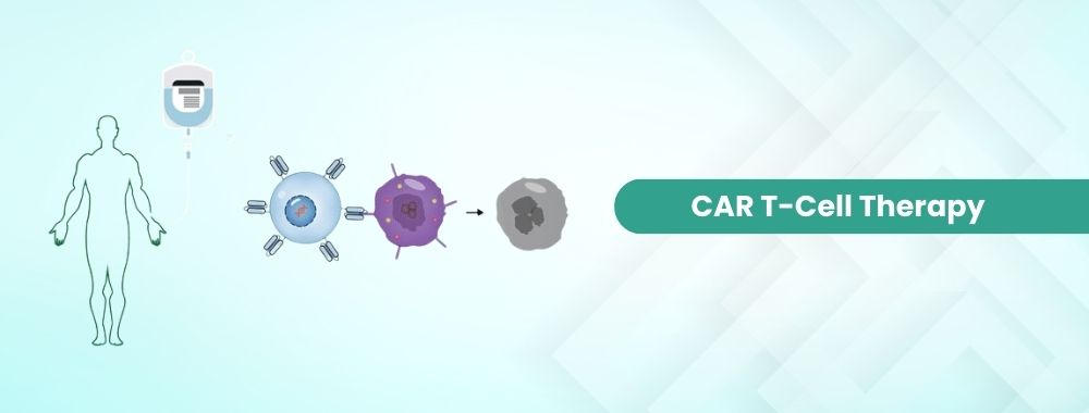 CAR T-Cell Therapy Cost in India | Advanced Cancer Care