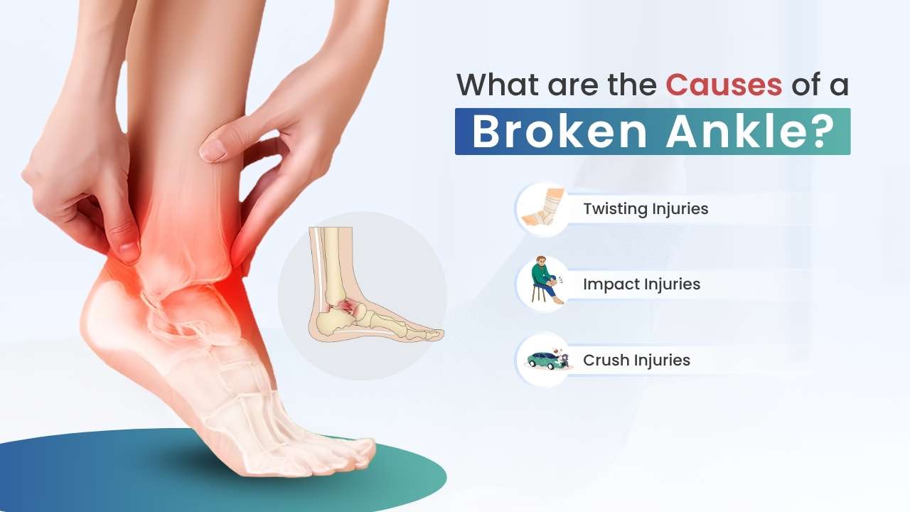How Long Does a Broken Ankle Take to Heal